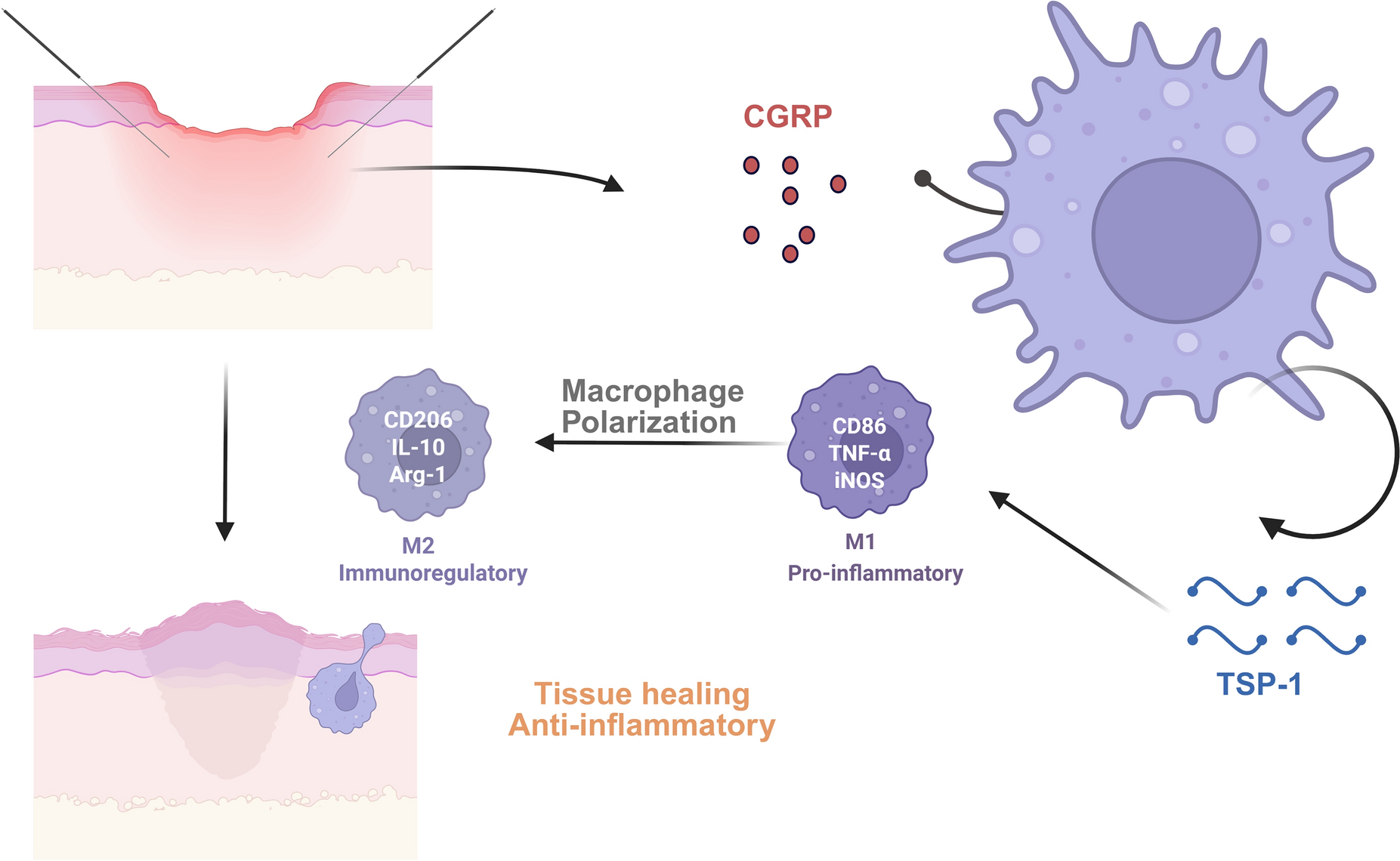 Acupuncture | Acupuncture accelerates wound healing via CGRP-RAMP1-TSP1 ...