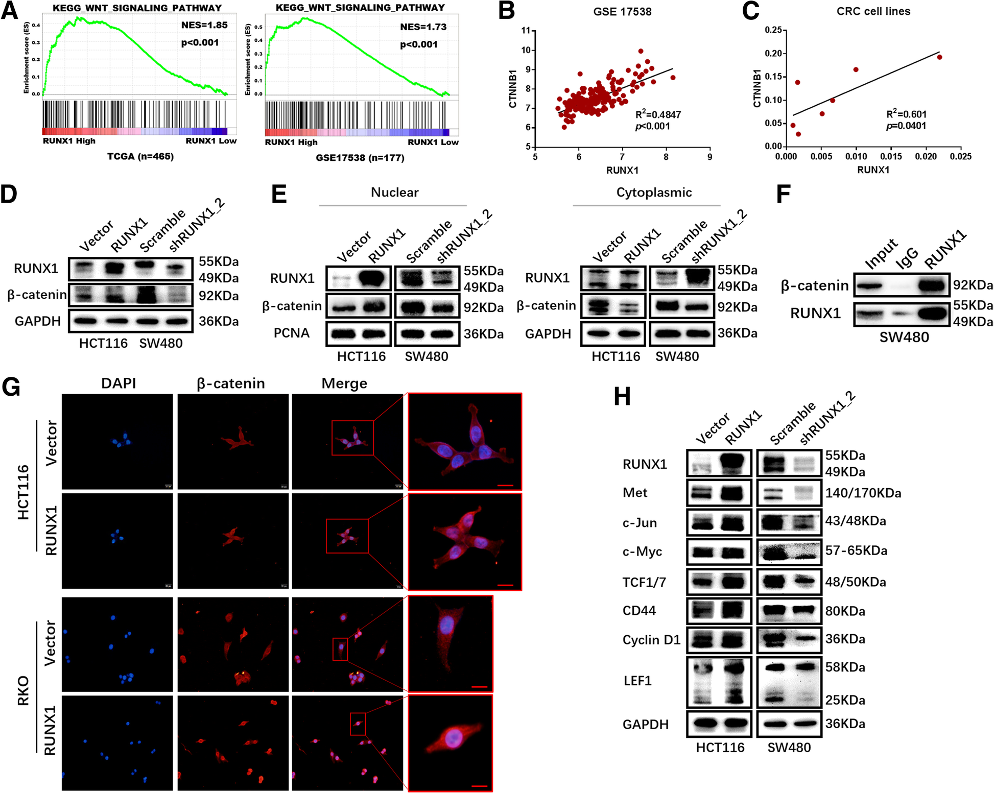 Runx1 Promotes Tumour Metastasis By Activating The Wnt β Catenin