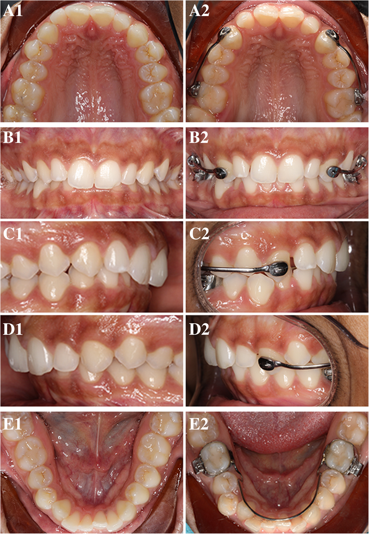 Evaluating the treatment effectiveness and efficiency of Carriere ...