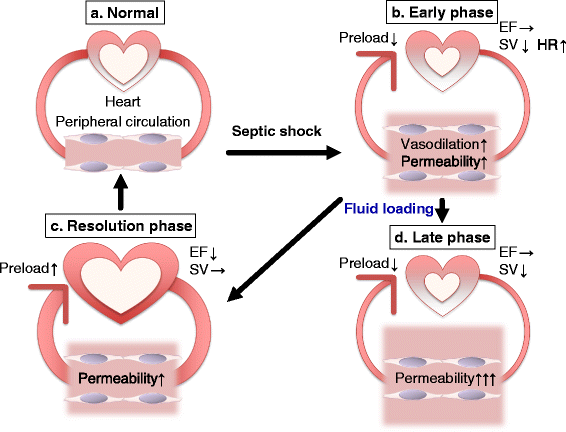 Sepsis-induced myocardial dysfunction: pathophysiology and management | SpringerLink