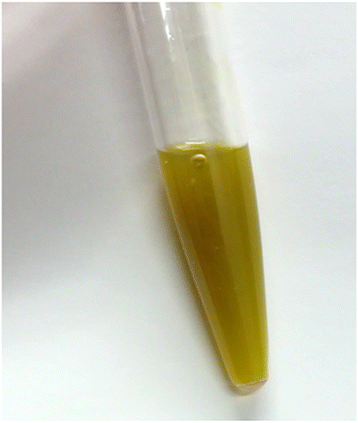 Gallbladder Drainage Color - Best Drain Photos Primagem.Org