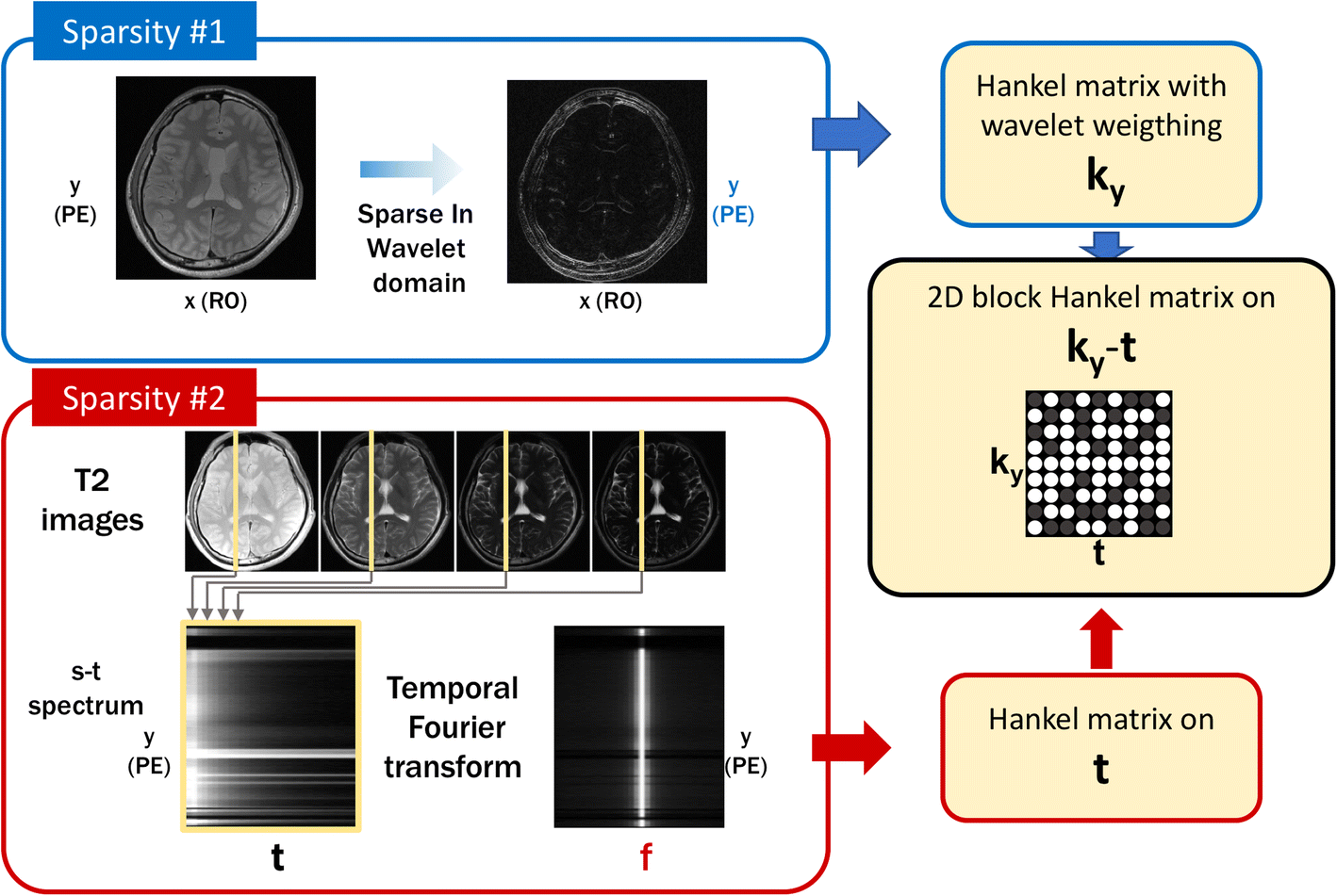 Compressed sensing MRI: a review from signal processing perspective ...