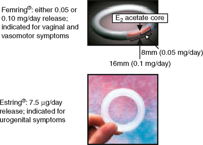 Vaginal Rings for Menopausal Symptom Relief | SpringerLink