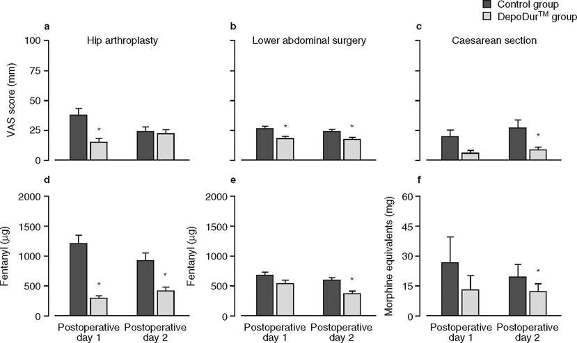 Pharmacology of Drugs Formulated with DepoFoam™ | SpringerLink