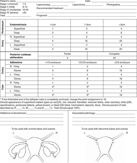 Endometriosis | SpringerLink