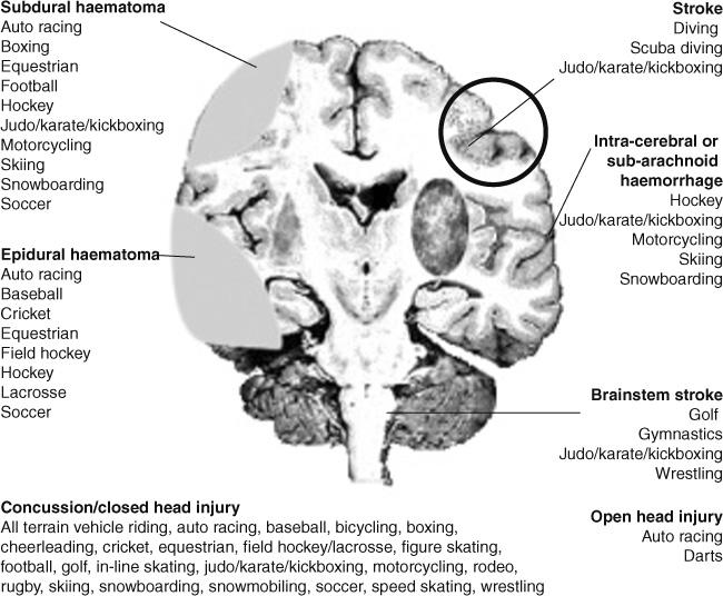 Central Nervous System Injuries in Sport and Recreation | SpringerLink