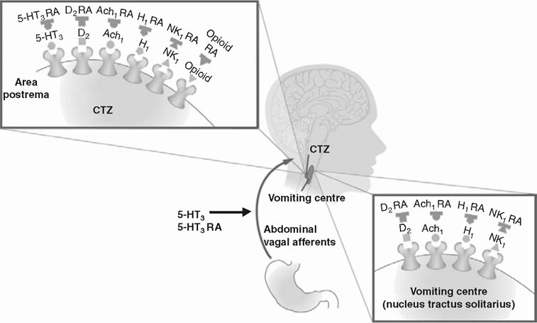 Mechanisms Underlying Postoperative Nausea and Vomiting and ...