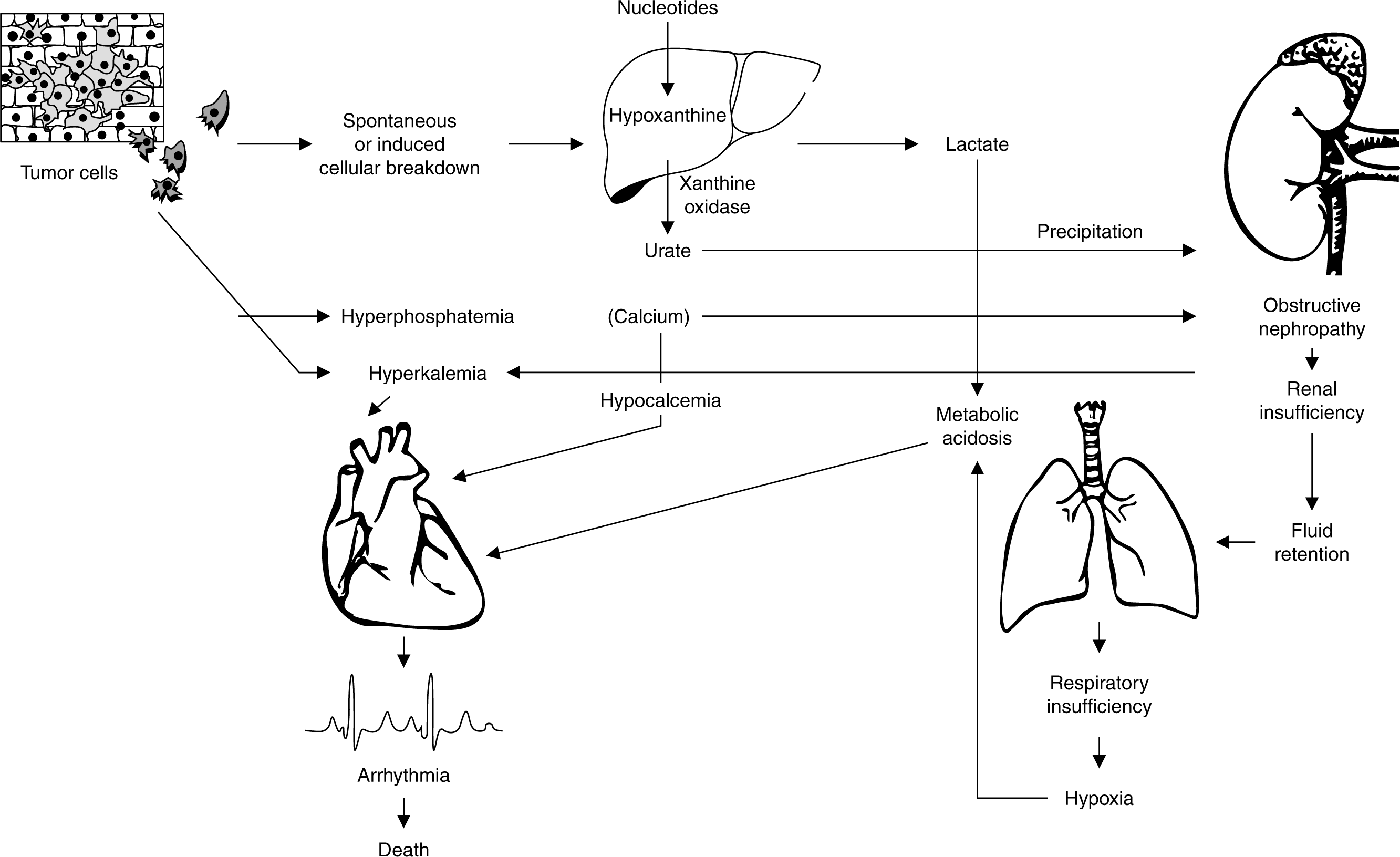 Hyperuricemia in Patients with Cancer | SpringerLink