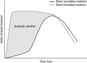 Anabolic Agents for Osteoporosis | SpringerLink
