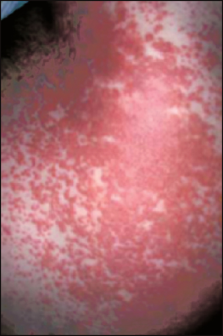 Progress in the Understanding of the Pathology and Pathogenesis of ...