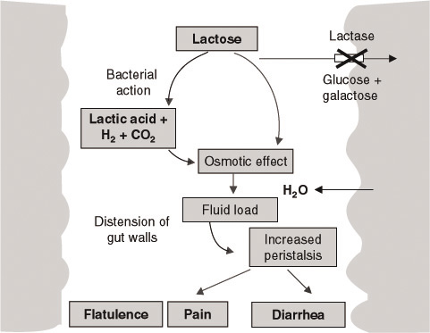 Genetic Variation and Lactose Intolerance | SpringerLink