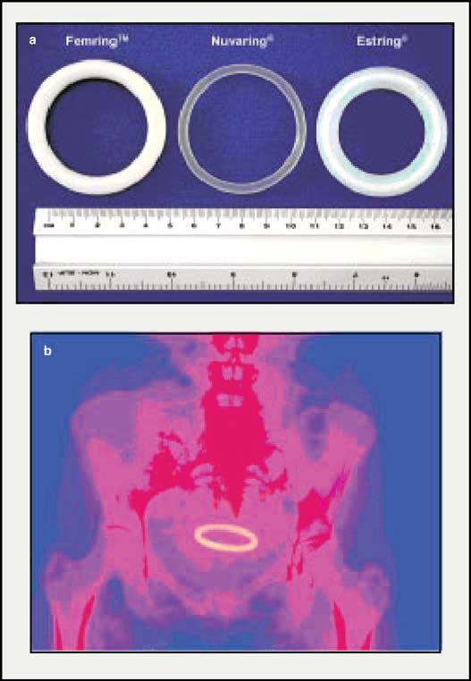 Potential use of vaginal rings for prevention of heterosexual ...
