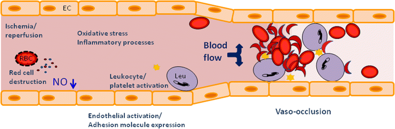 Red cell DAMPs and inflammation | SpringerLink