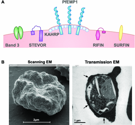 Surface antigens of Plasmodium falciparum-infected erythrocytes as ...