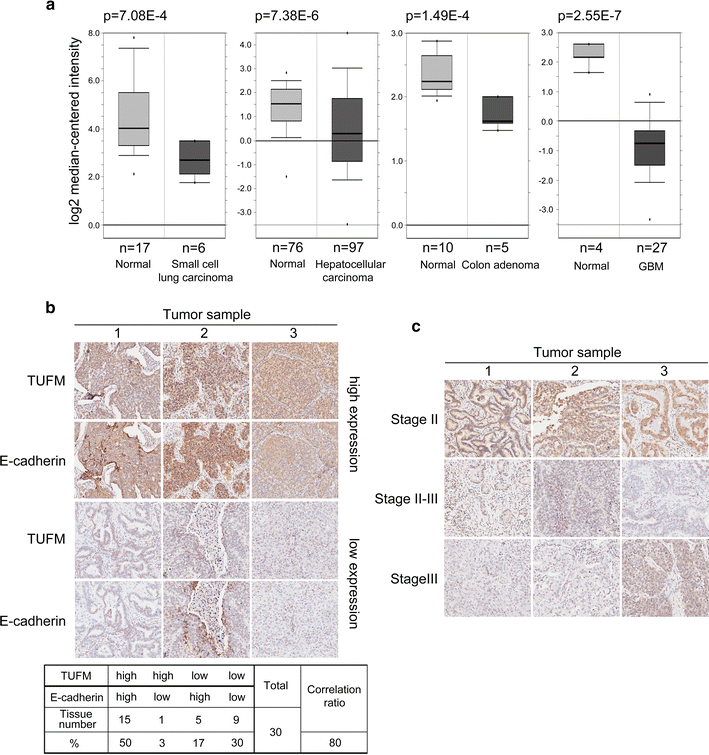 TUFM downregulation induces epithelial–mesenchymal transition and ...