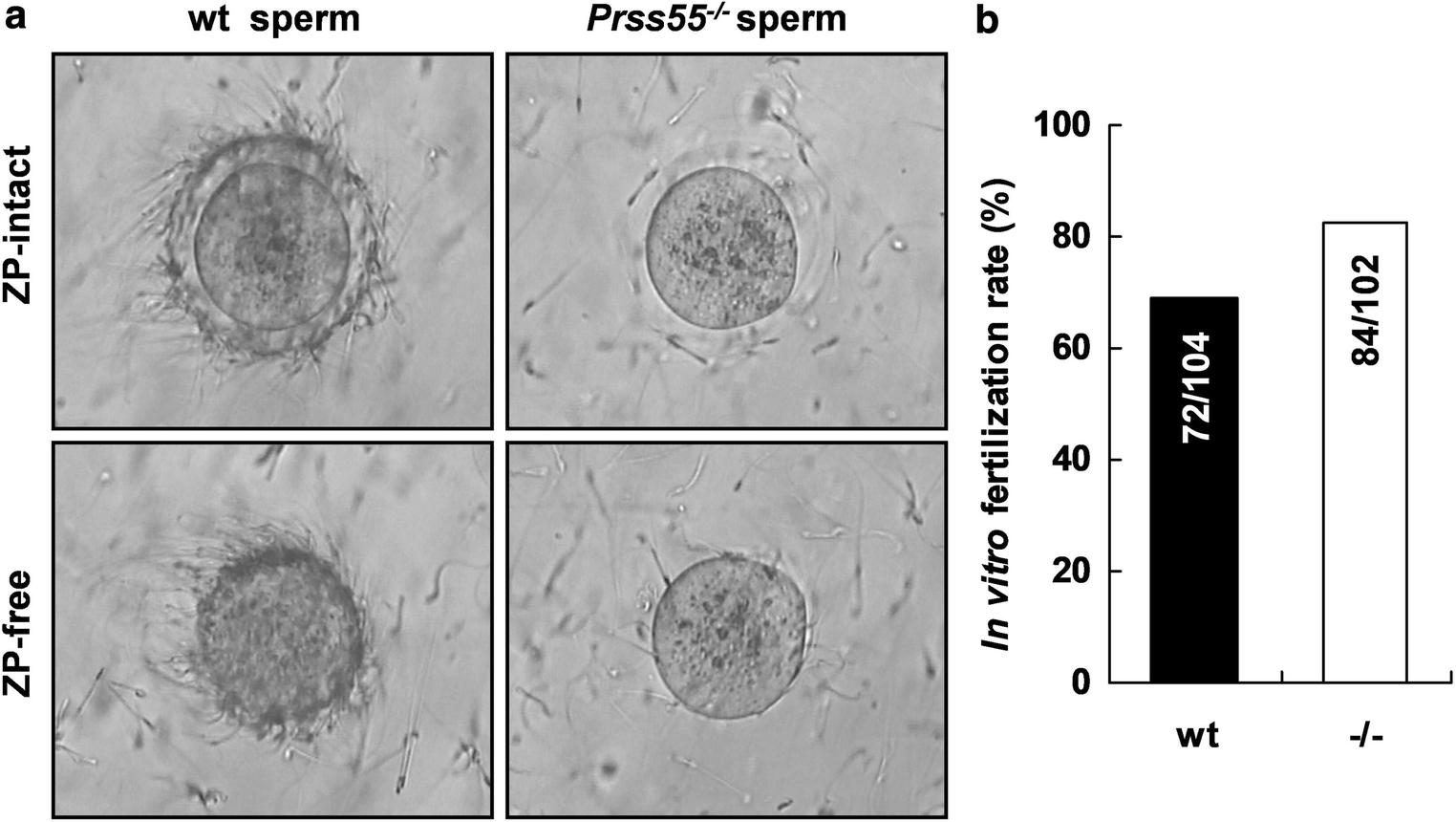 Serine protease PRSS55 is crucial for male mouse fertility via ...