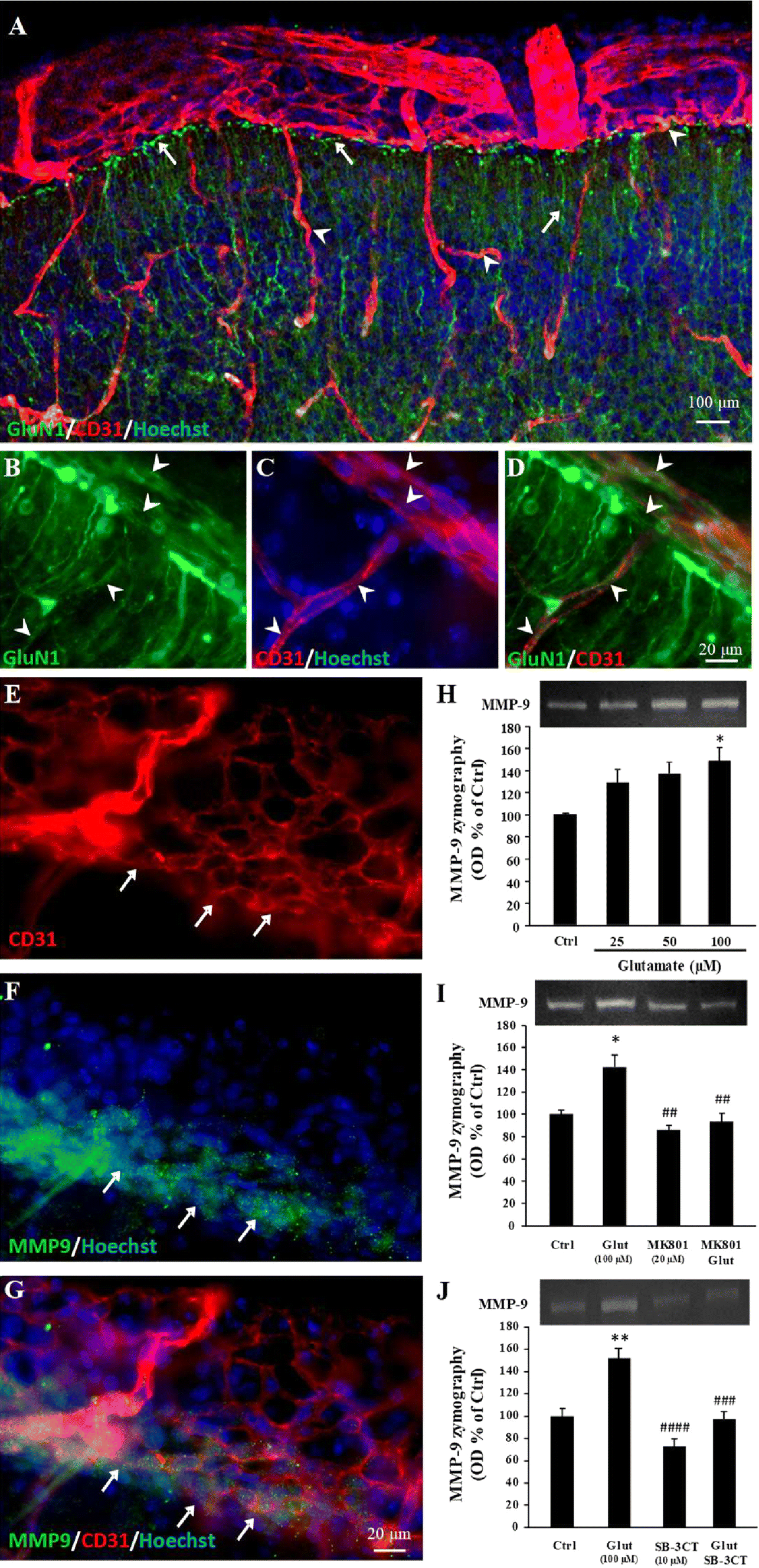 Glutamate controls vessel-associated migration of GABA interneurons ...