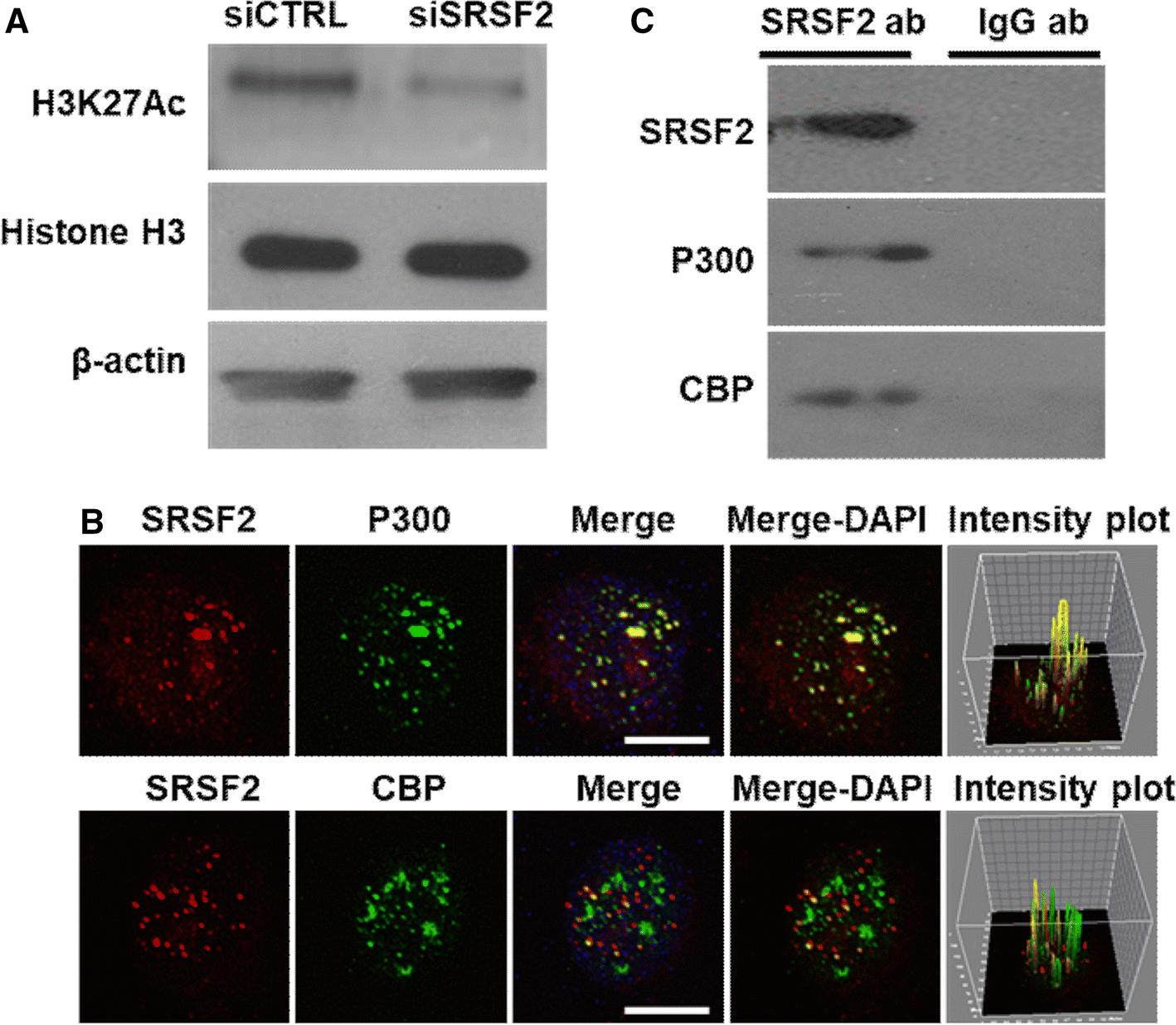 Modulation of SRSF2 expression reverses the exhaustion of TILs via the ...