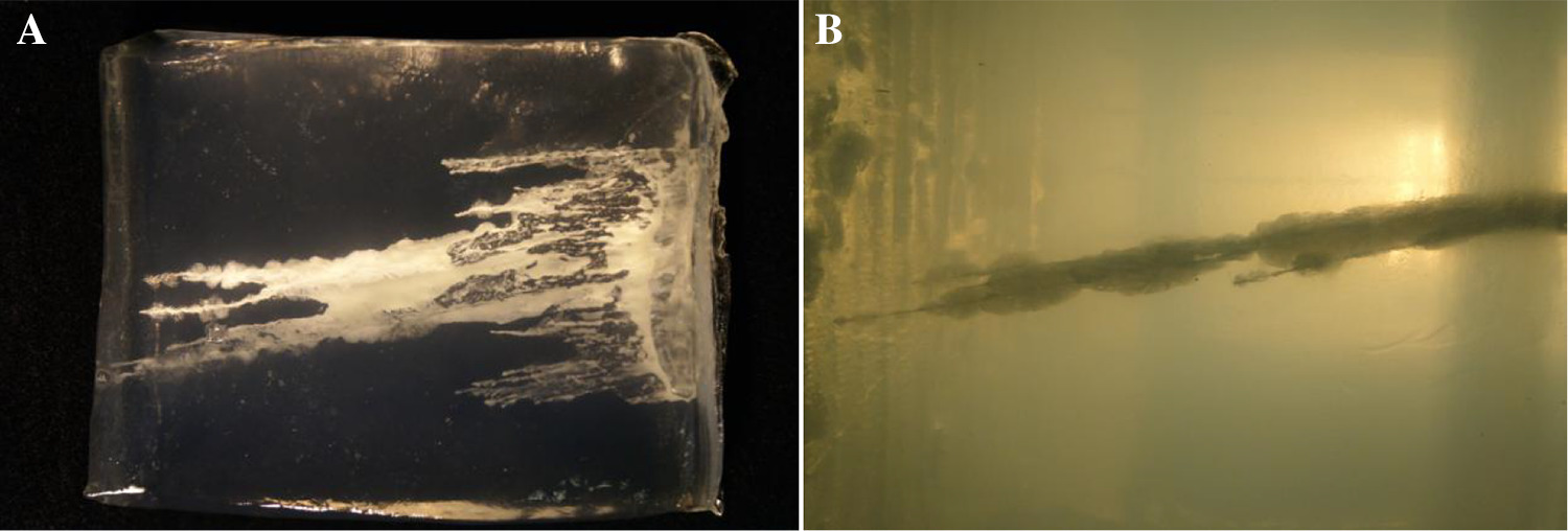 Management of industrial high-pressure fluid injection injuries (IHPFII ...