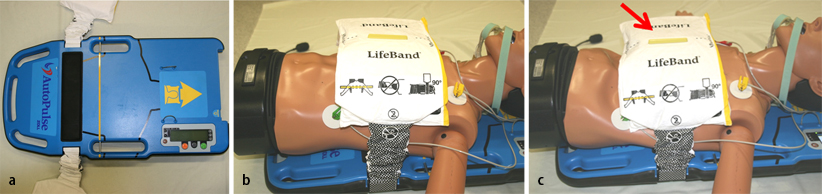 Mechanische Reanimationshilfen | SpringerLink