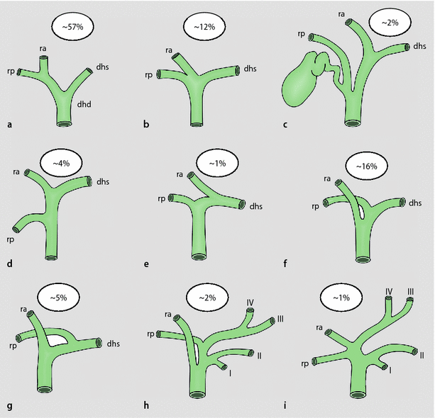 Technik der Leberresektion | SpringerLink