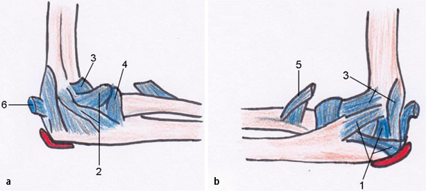 Frakturen des Ellenbogengelenkes | SpringerLink