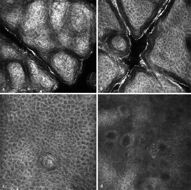 Konfokale Laserscan-Mikroskopie | SpringerLink