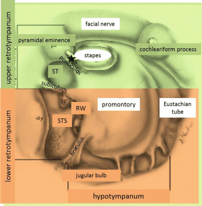 Endoscopic ear surgery – a complement to microscopic ear surgery ...