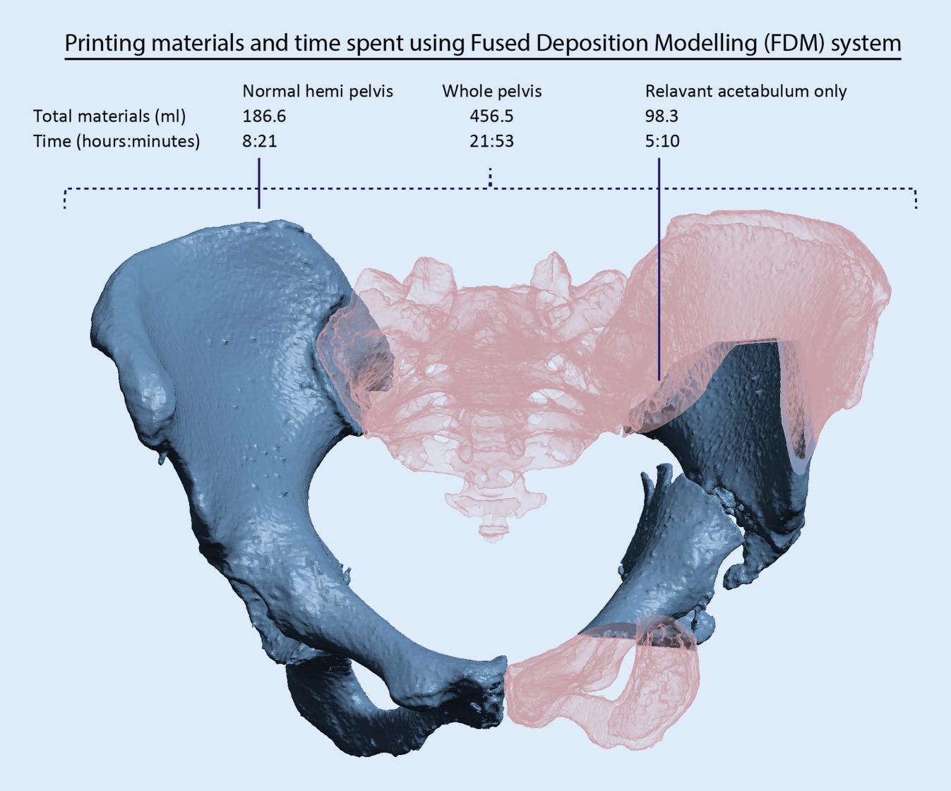 Surgical applications of three-dimensional printing in the pelvis and ...