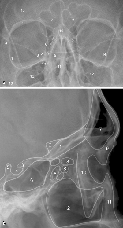 Orbita – Anatomie, Entwicklung und Fehlbildungen | SpringerLink
