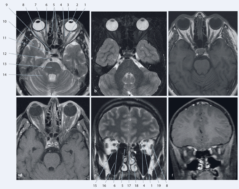 Orbita – Anatomie, Entwicklung und Fehlbildungen | SpringerLink
