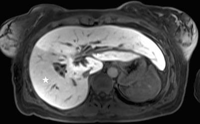 Funktionelle MR-Tomographie der Leber | SpringerLink