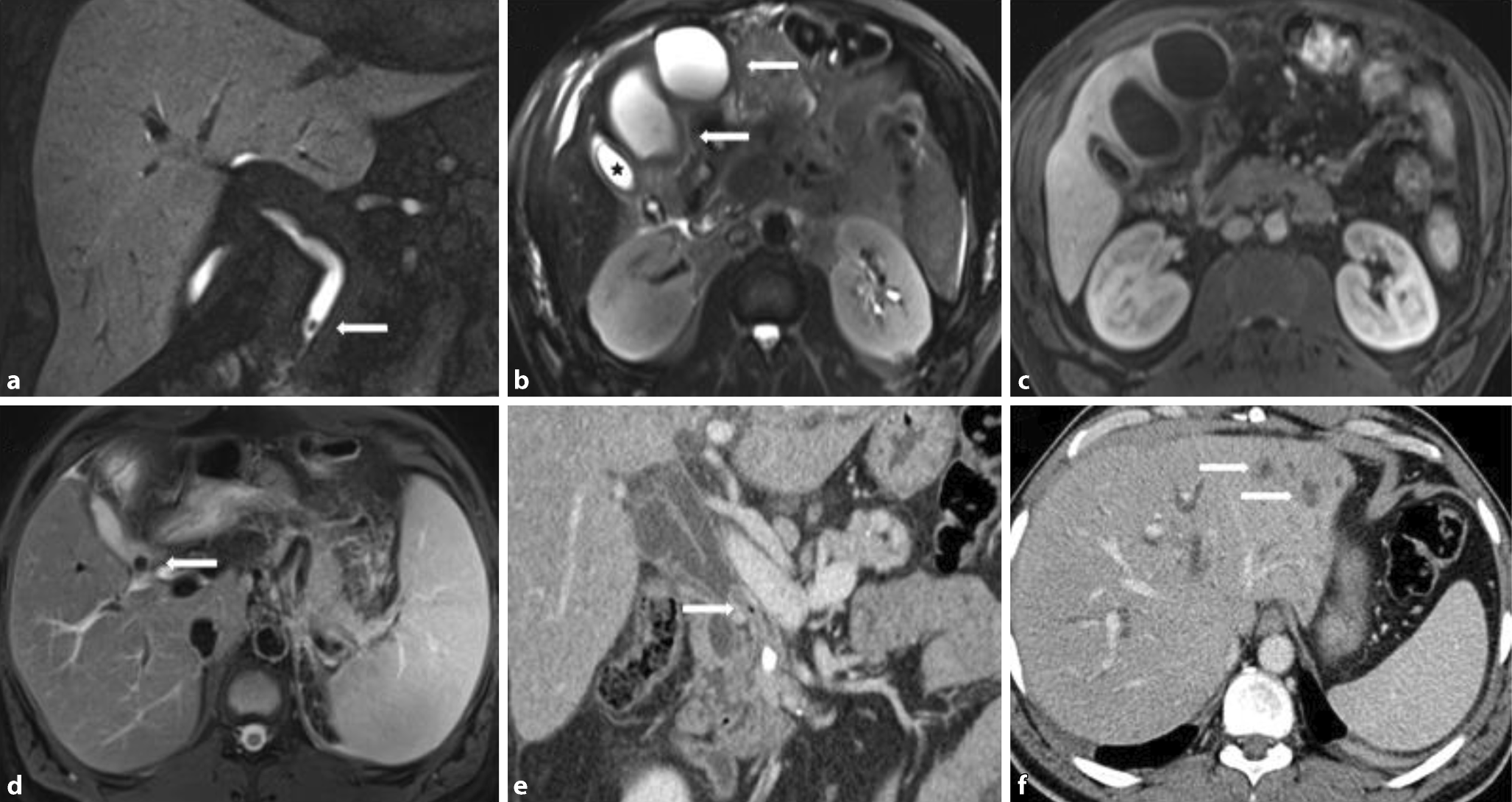 Differenzialdiagnosen von Gallenwegerkrankungen | SpringerLink