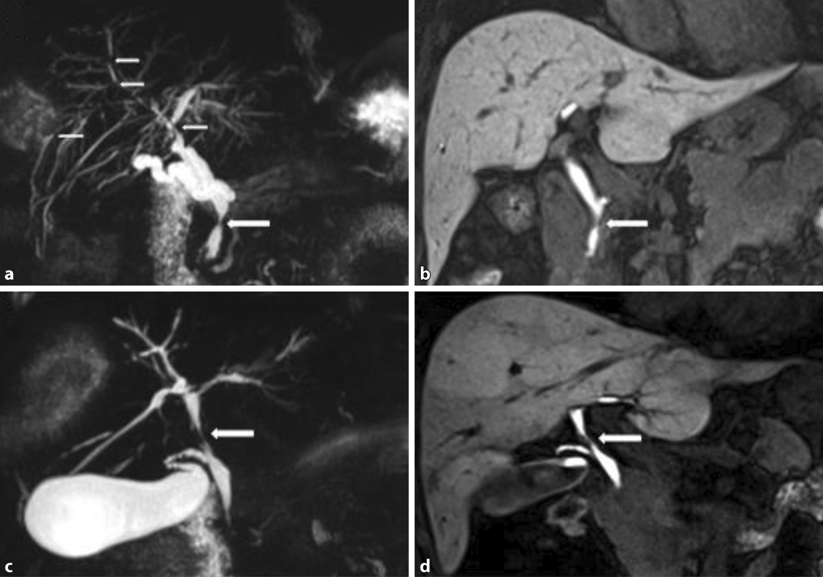 Differenzialdiagnosen von Gallenwegerkrankungen | SpringerLink