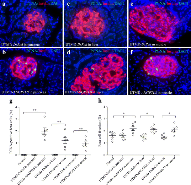 In vivo targeted delivery of ANGPTL8 gene for beta cell regeneration in ...
