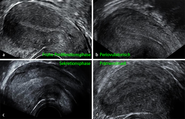 Sonographie in der Gynäkologie | SpringerLink