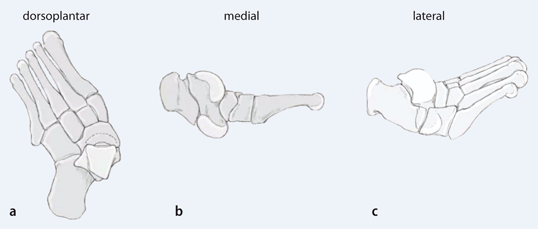 Talus verticalis | SpringerLink