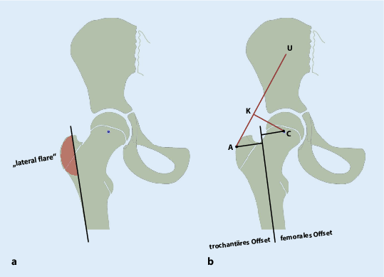 Die großen Apophysen | SpringerLink