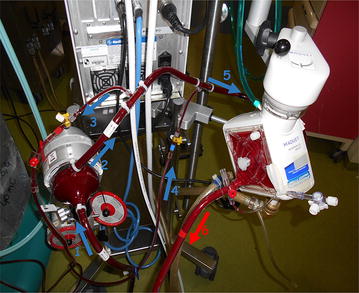 Ten things that nurses should know about ECMO | SpringerLink