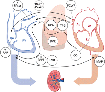 Preoperative right heart hemodynamics predict postoperative acute ...