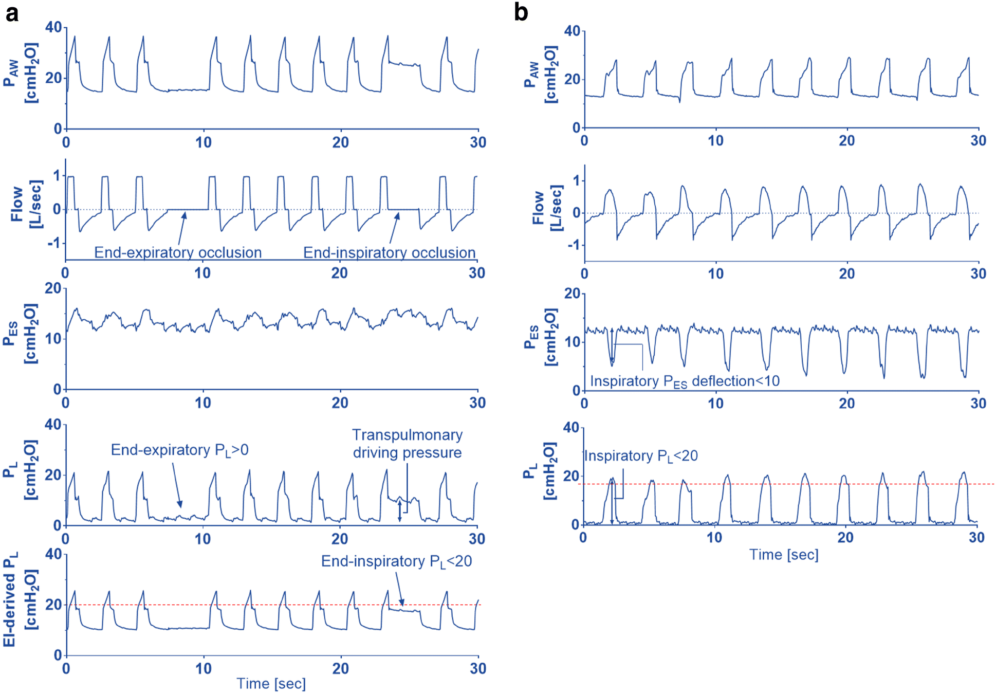 Guiding ventilation with transpulmonary pressure | SpringerLink