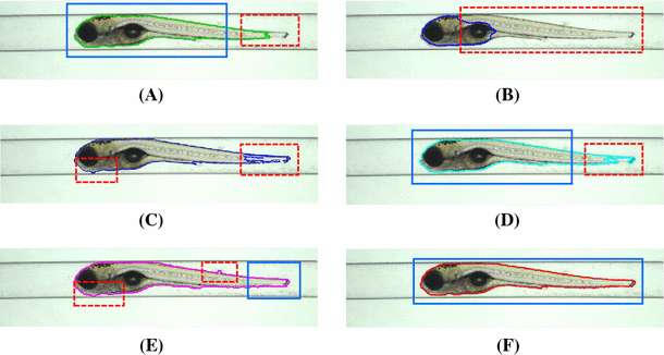 An efficient and robust hybrid method for segmentation of zebrafish objects from bright-field ...