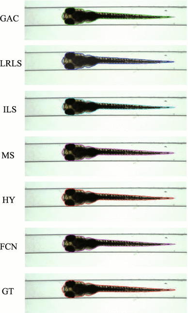 An efficient and robust hybrid method for segmentation of zebrafish objects from bright-field ...
