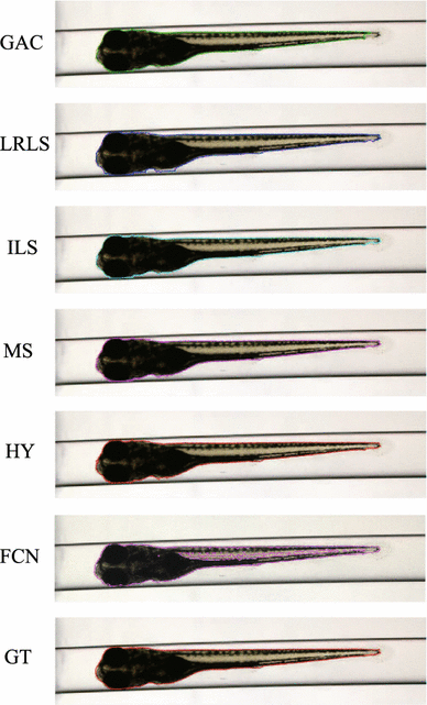 An efficient and robust hybrid method for segmentation of zebrafish objects from bright-field ...