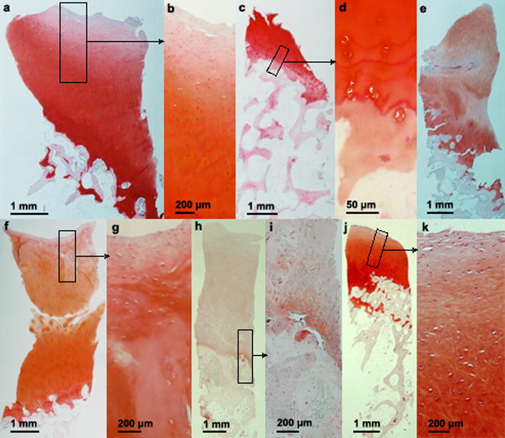 Matrix-induced autologous chondrocyte implantation (MACI) in the knee ...