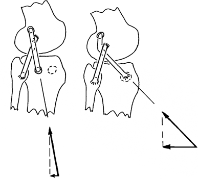 Anterolateral knee biomechanics | SpringerLink
