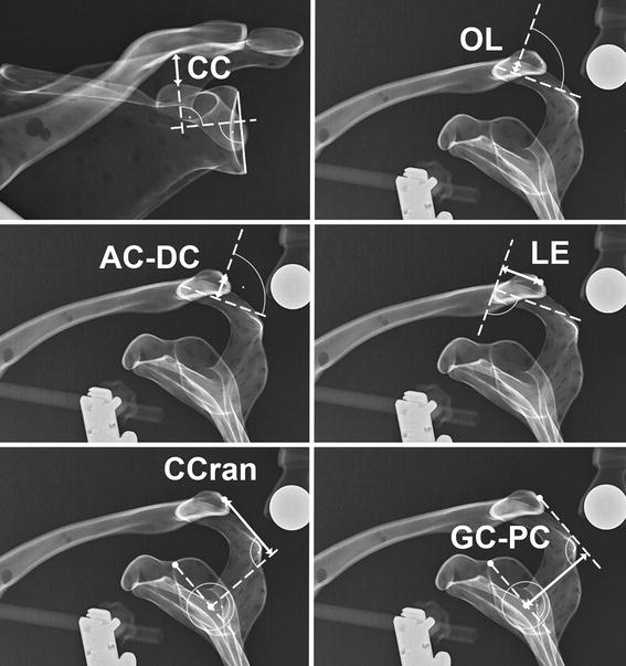 New quantitative radiographic parameters for vertical and horizontal ...