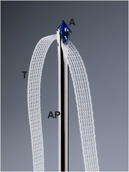 Outpatient mid-urethral tissue fixation system sling for urodynamic ...