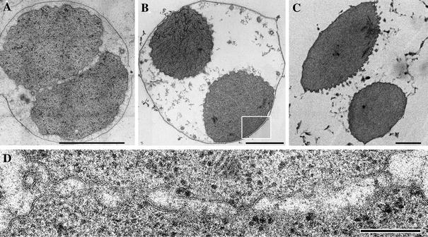 Ignicoccus hospitalis and Nanoarchaeum equitans: ultrastructure, cell ...
