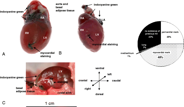 Minimally invasive closed-chest ultrasound-guided substance delivery ...
